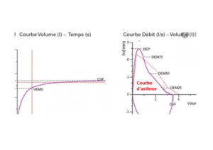 EFR | Explorations - fonctionnelles – Respiratoires - CMSEA